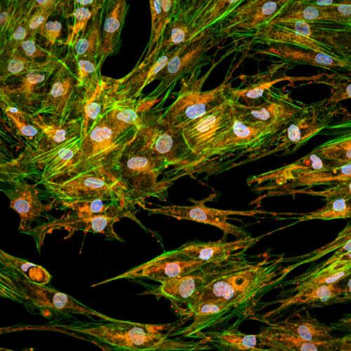 Discover the new ImageXpress HCS.ai High-Content Screening System