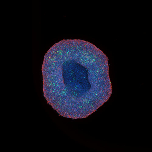 Discover the new ImageXpress HCS.ai High-Content Screening System